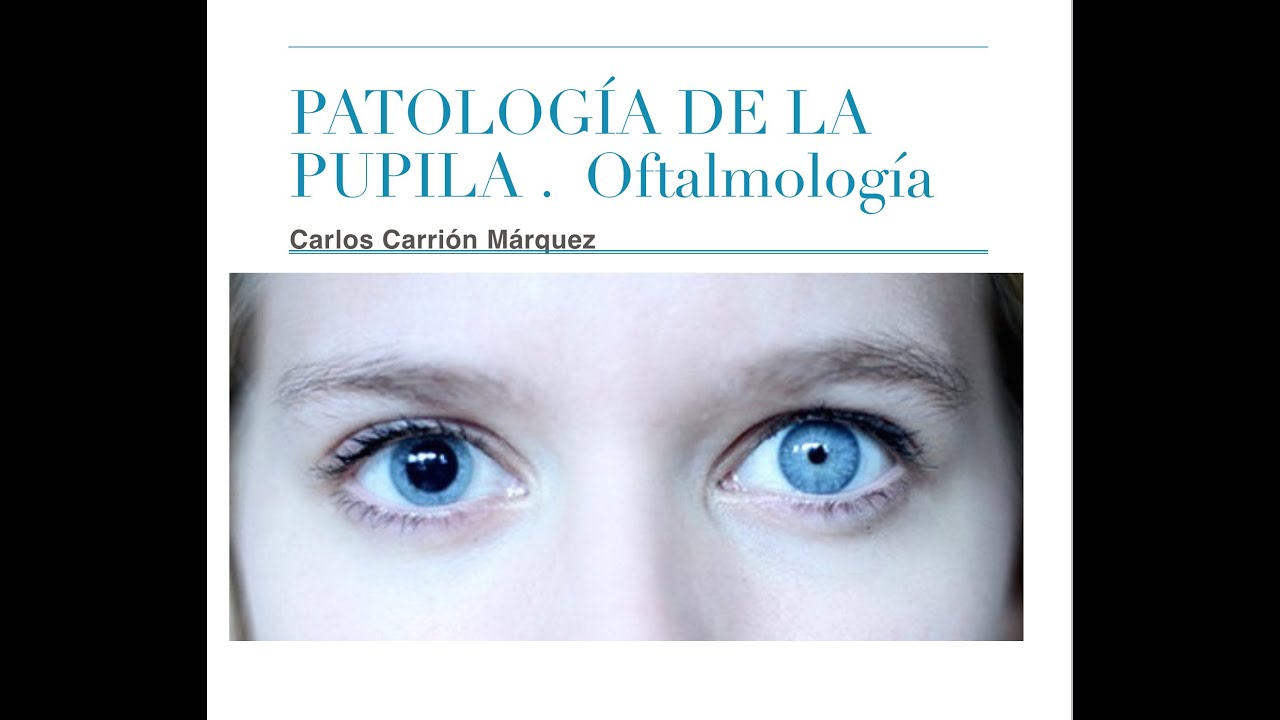 Identificar Pupilas Opiaceos