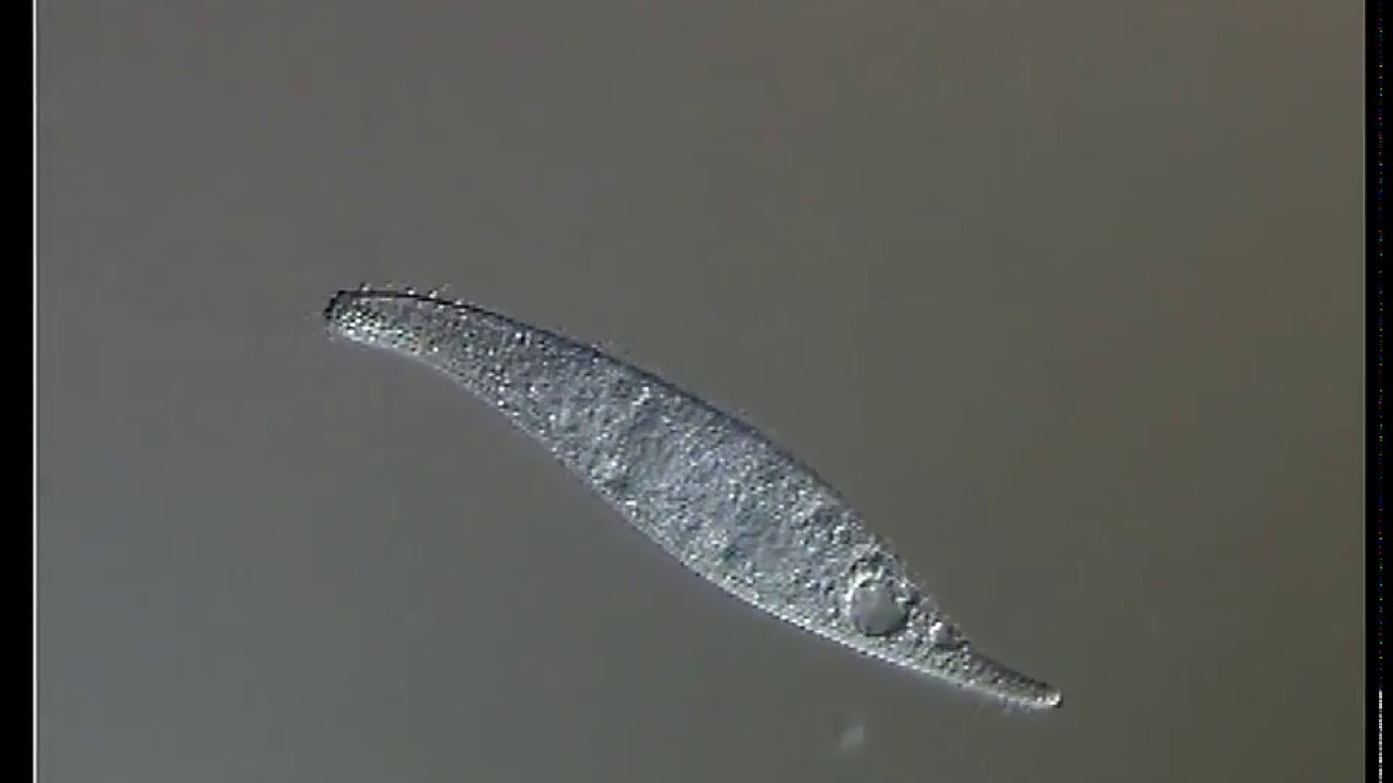 AMPHILEPTUS CILIADO CILIATE. DIC Nikon Microphot - YouTube