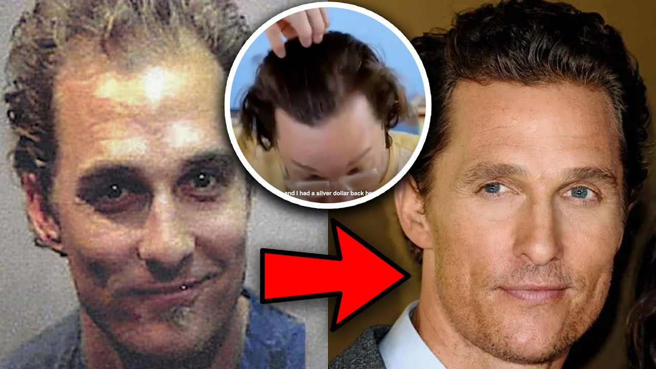 Matthew Mcconaughey Hair Loss
