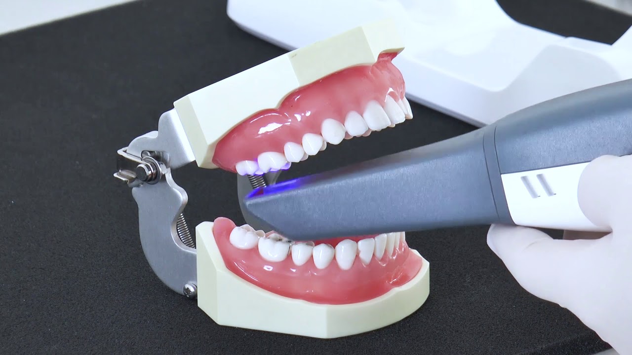 Cameo Intraoral Scanner 15s - YouTube
