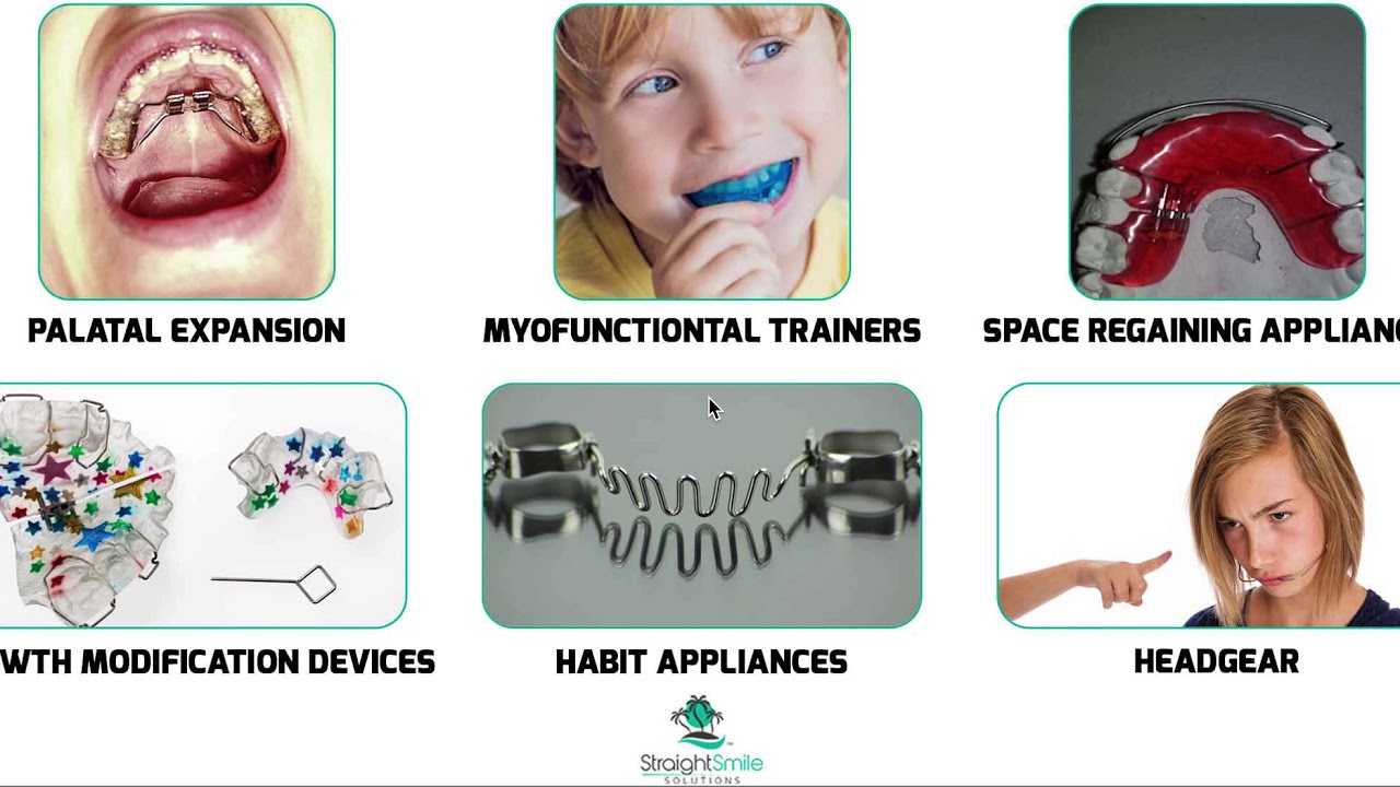 Functional, Expansion and Growth Modification Appliances https://www ...