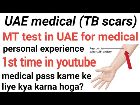 uae medical for TB scars | MT test in uae medical | info online - YouTube