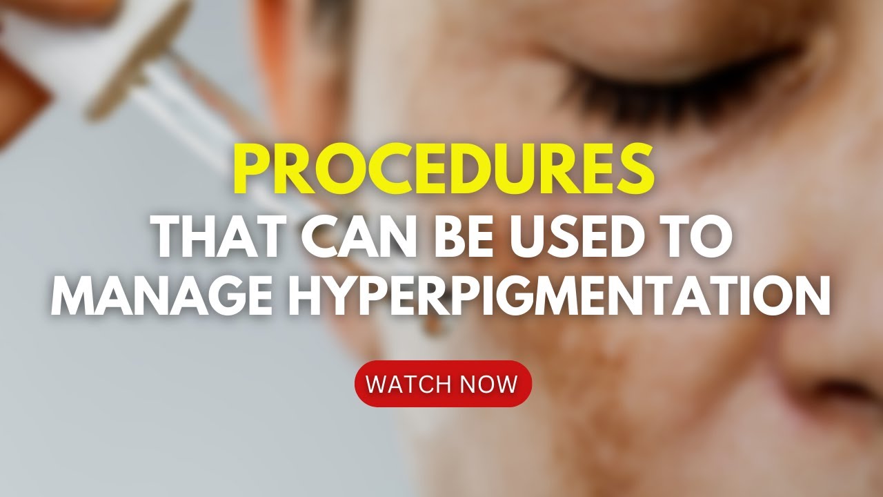 Hyperpigmentation Solutions: Top Procedures to Try #skincare - YouTube