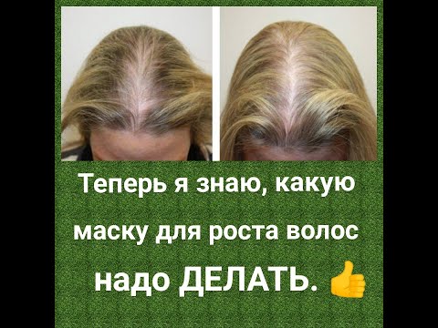 Супер маска для РОСТА ВОЛОС и против ВЫПАДЕНИЯ.