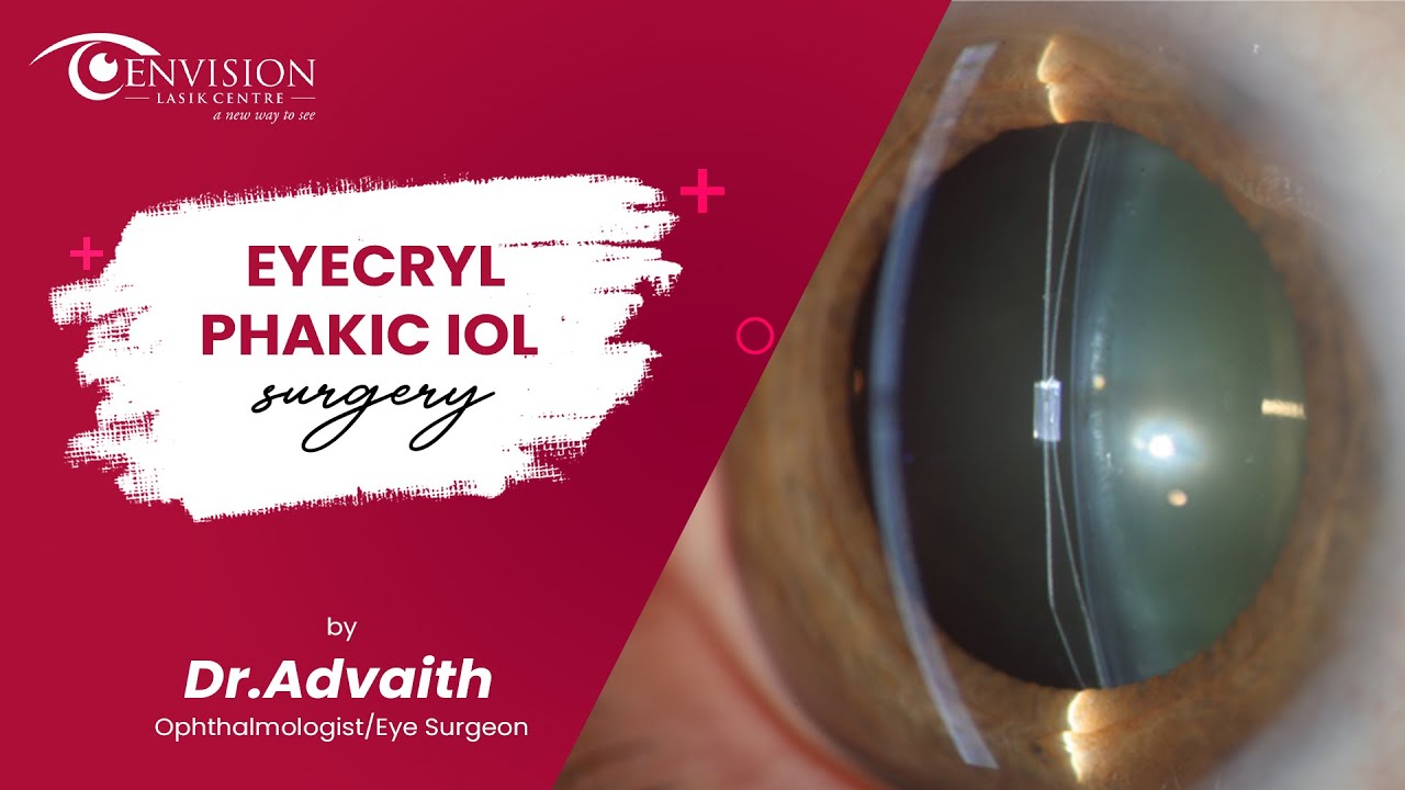 Eyecryl Phakic IOL Eye surgery | Best Ophthalmologist | Best Eye ...