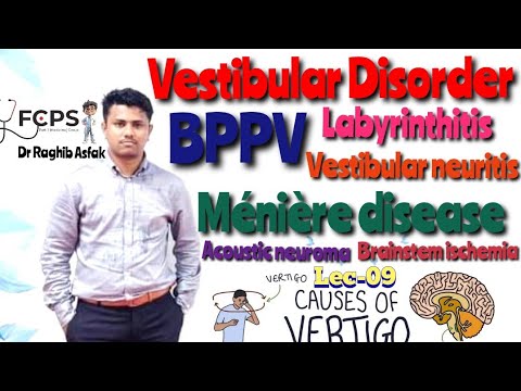 Vestibular disorder, BPPV,Meniere's disease,B.I,Vestibular neuritis,A.N ...