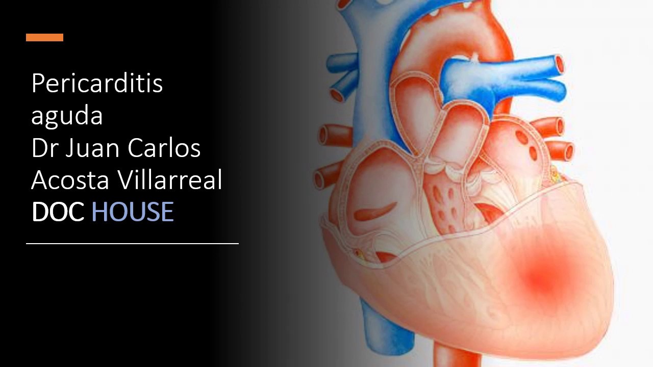 Pericarditis IMPERDIBLE!!! ENARM ¡USEN BOCINAS O AUDIFONOS PARA ...