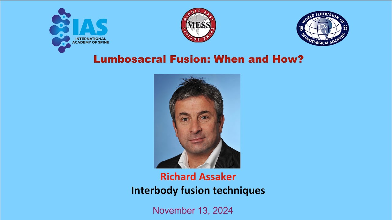 Lumbosacral fusion: When and How?Interbody fusion techniques. Richard ...
