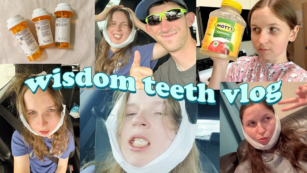 My Wisdom Teeth Vlog! - YouTube