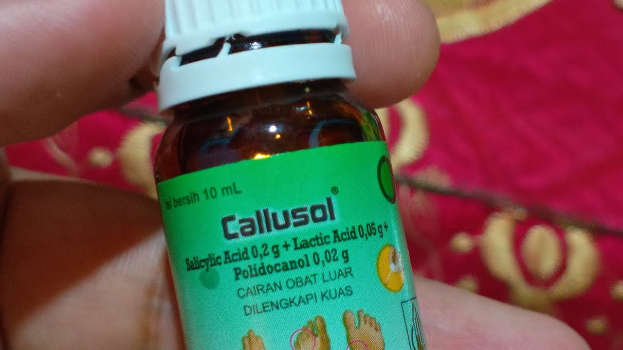 Review Obat Callusol untuk Pengobatan Mata Ikan di kaki - YouTube