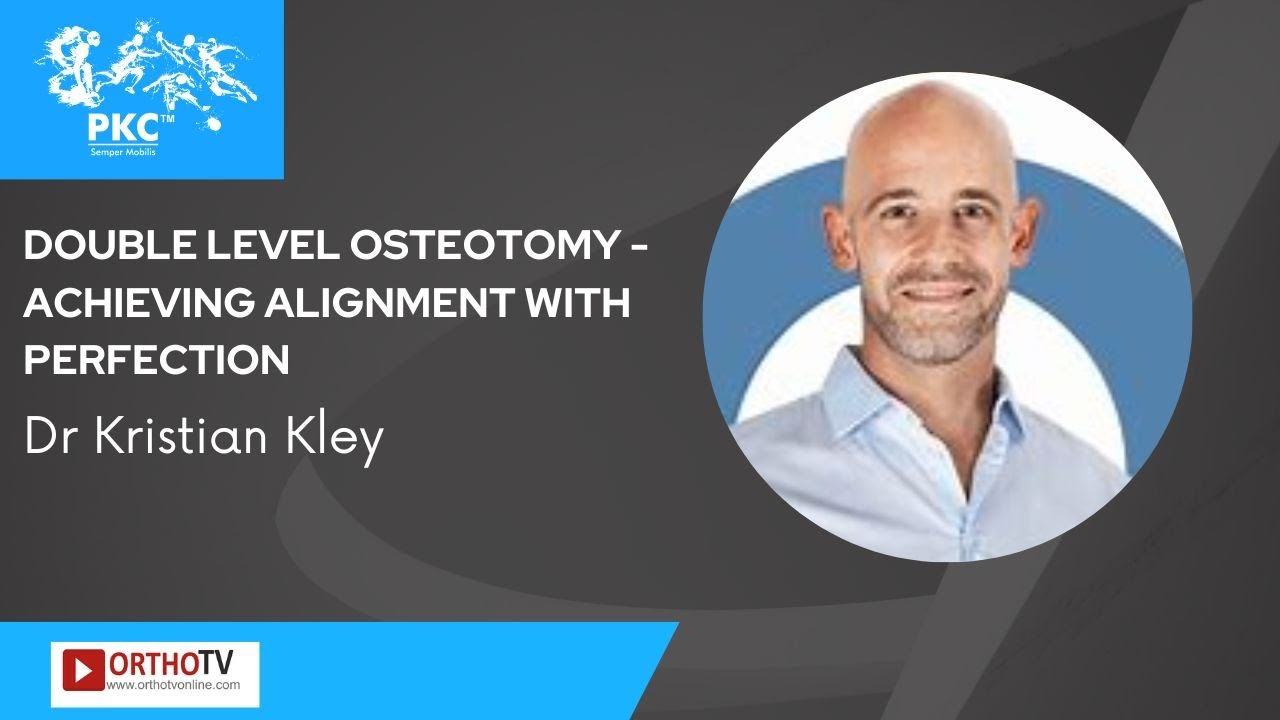 Double Level Osteotomy - Achieving Alignment with Perfection - Dr ...