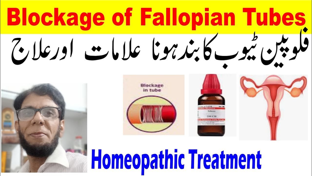 Band fallopian Tube ka Homeopathic ilaj - YouTube