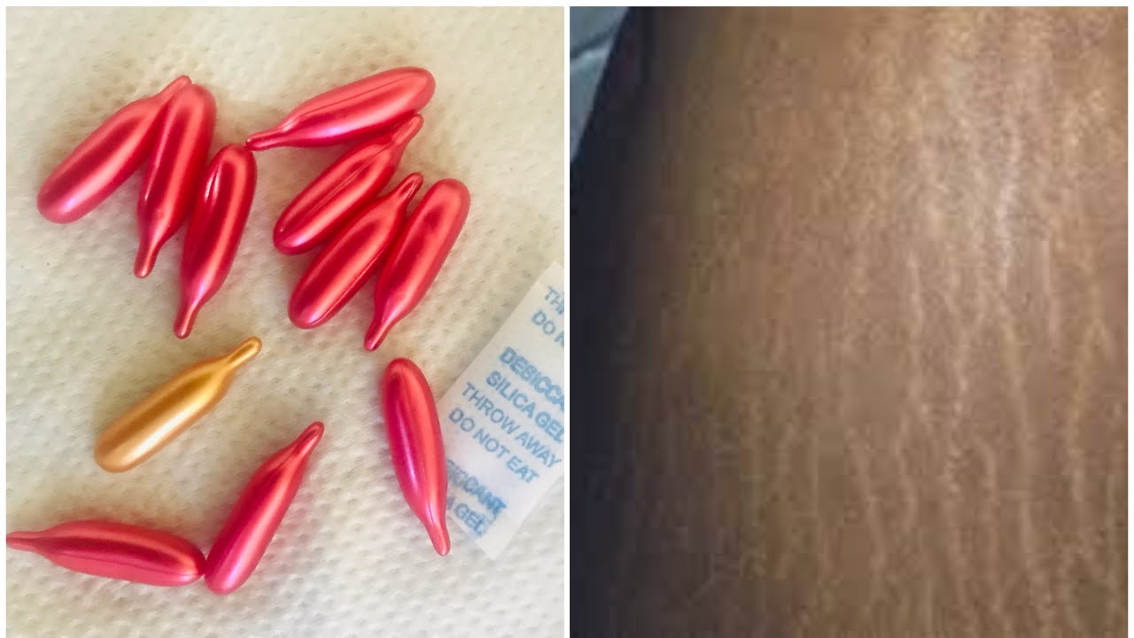 DAWA KIBOKO YA MICHIRIZI !!! TUMIA HII UBAKI NA NGOZI SAFII YA ...