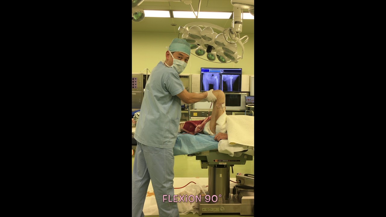 Bipolar hip arthroplasty(BHA) in femoral neck fracture - YouTube