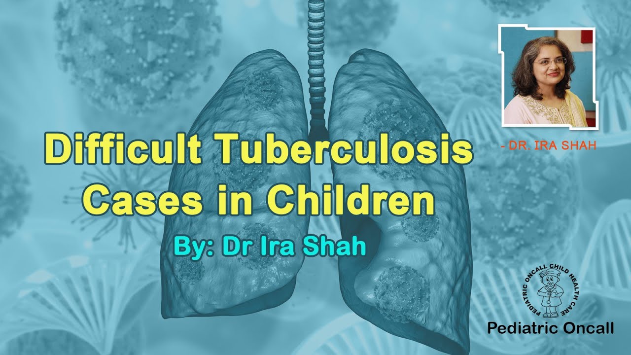 Difficult Tuberculosis Cases in Children - YouTube