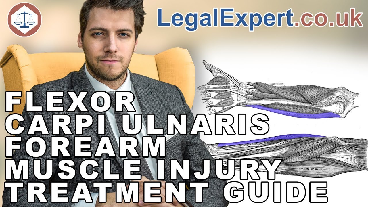 Flexor Carpi Ulnaris Forearm Muscle Injury Treatment Guide ( 2019 ) UK ...