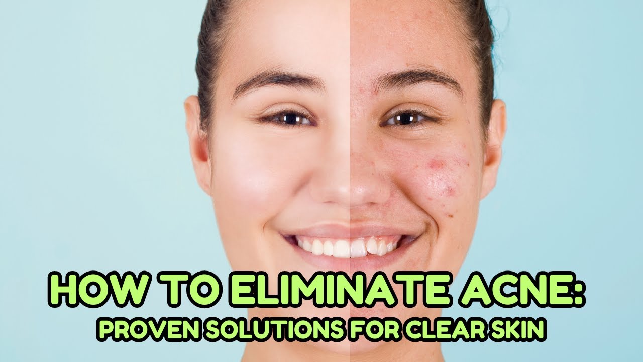 How to Eliminate Acne: Proven Solutions for Clear Skin - YouTube