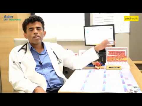 Aster Hospital - Dr.Sanjay Bhat Interview Latest 2023 - YouTube