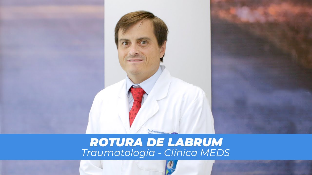 Rotura de Labrum - Clínica MEDS - YouTube