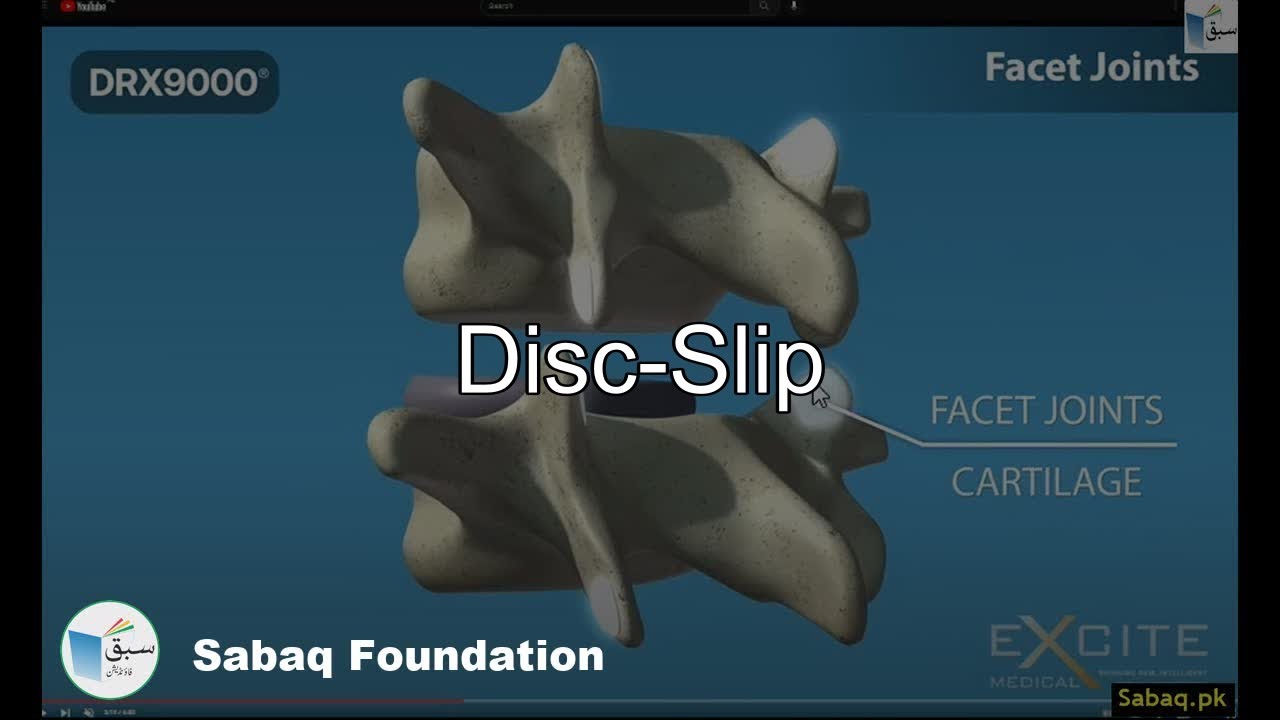 Disc-Slip, Biology Lecture | Sabaq.pk - YouTube