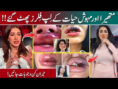 Mathira or Mehwish Hayat's Lip Fillers Gone Wrong! | Mehwish Hayat ...