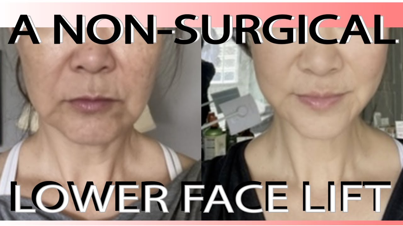 THE BEST FACE EXERCISES THAT LIFTS THE LOWER FACE. - YouTube