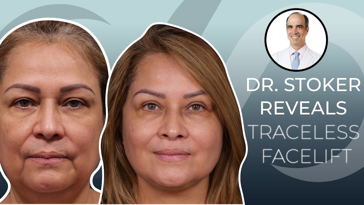 The 6 Secrets to Looking Younger | Dr. David Stoker - YouTube