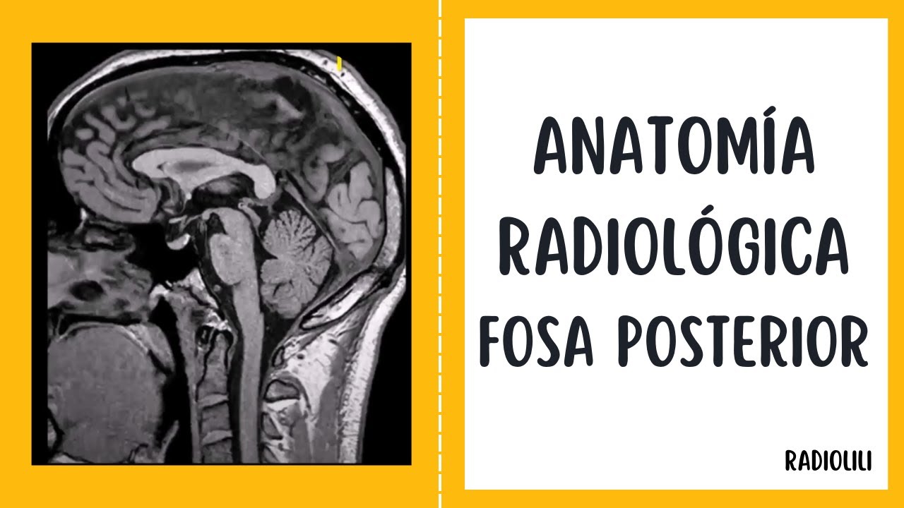 Anatomía Radiológica - Resonancia Magnética: Fosa posterior. - YouTube
