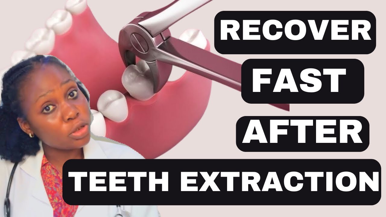 Tips For Quick Recovery After TEETH EXTRACTION. Speed Up the healing ...