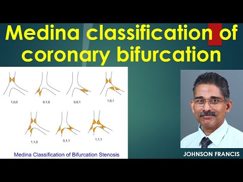 Medina Classification of Coronary Bifurcation - YouTube