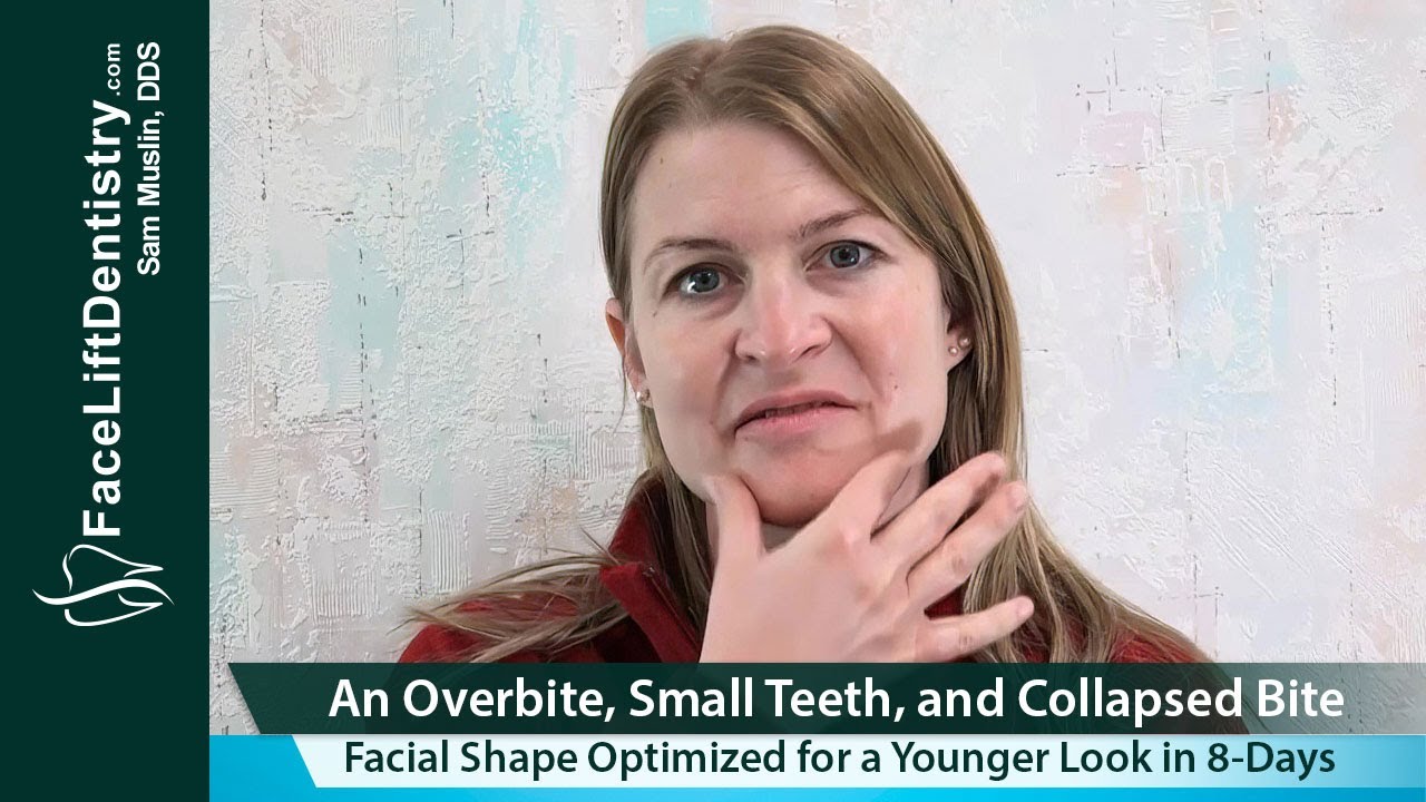 Deep Overbite Correction, Chin Size, Face Shape, Premature Aging ...