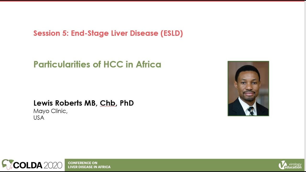 Particularities of HCC in Africa | Lewis Roberts, MB, Chb, PhD - YouTube