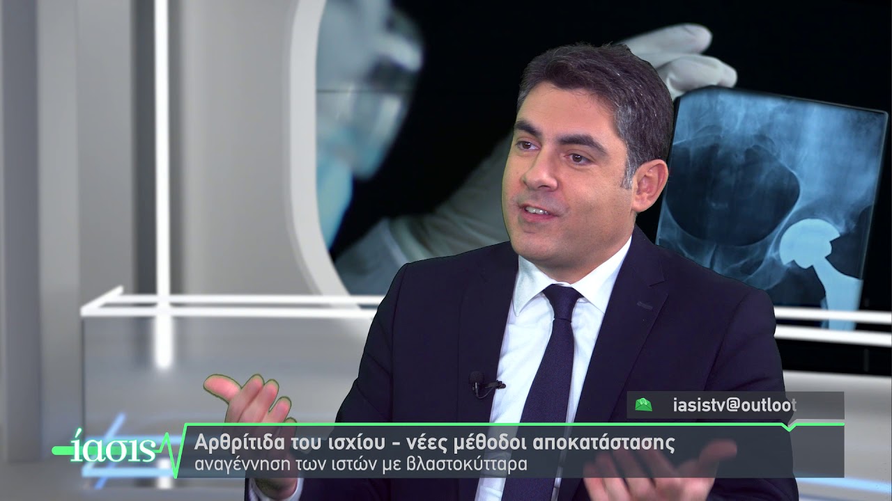 ΙΑΣΙΣ Tv - Αρθροπλαστική ισχίου – νέες μέθοδοι αποκατάστασης, τέλος ...
