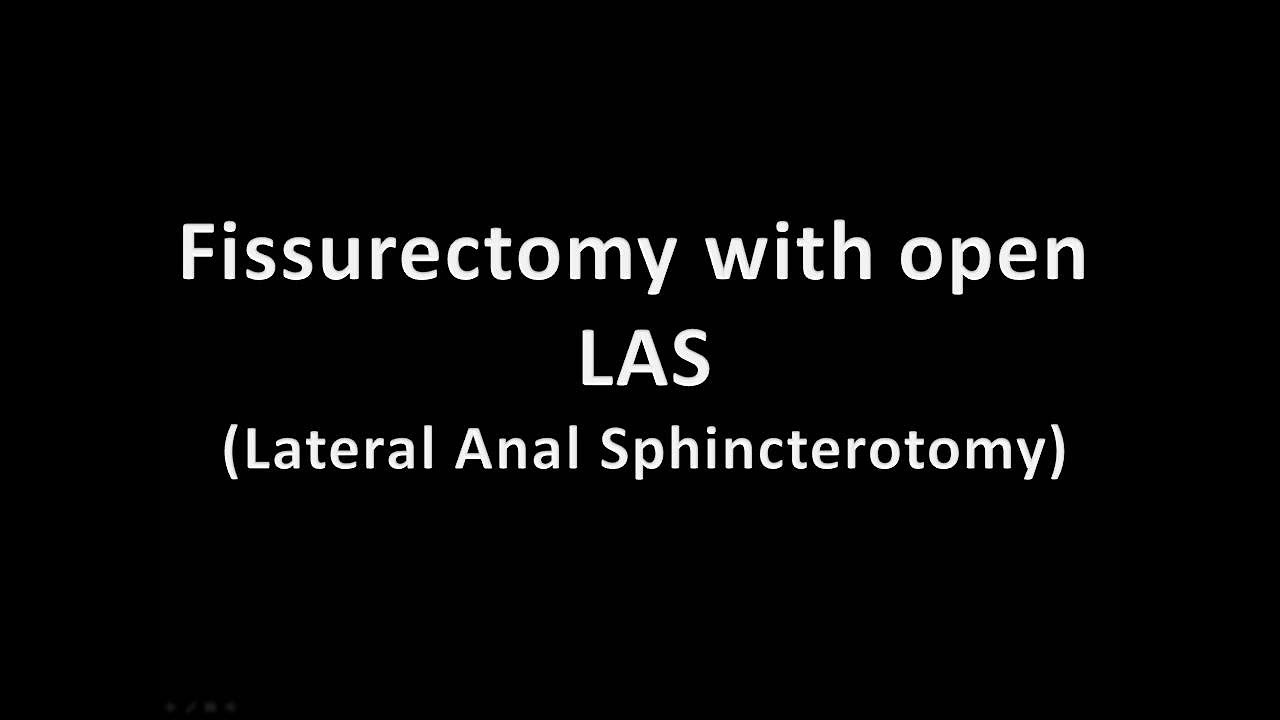 Fissurectomy with Open LAS - YouTube