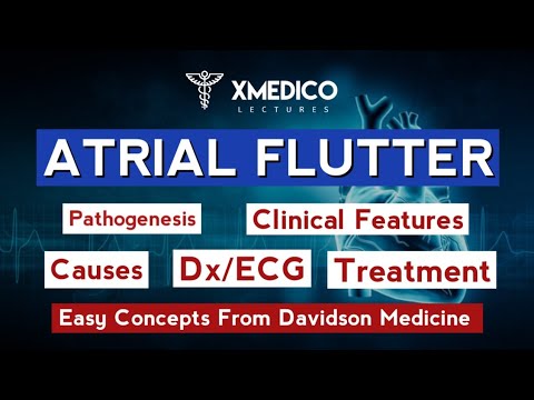 Atrial flutter pathogenesis, clinical features, causes, diagnosis, and ...