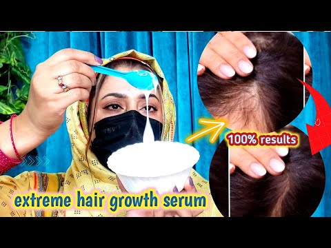 Must try this hair serum || Got amazing results || aik bi bal nai totta ab mera #zainabnumanofficial