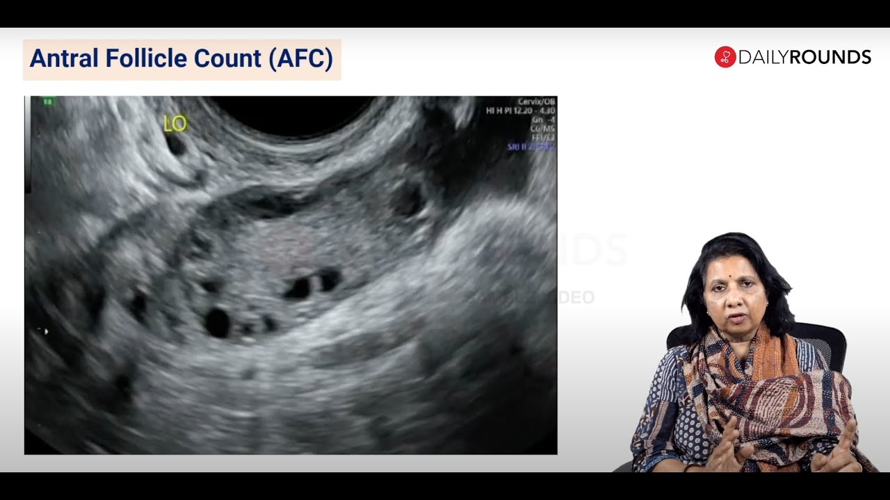 Gynaec Imaging Sample Video | Baseline Scan by Dr. Supriya Seshadri ...
