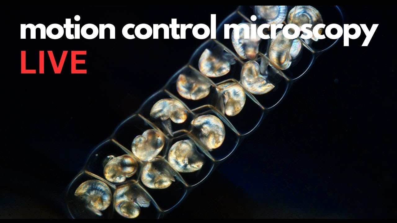 Eggs, mites and maggots - Pond water microscopy with a twist. - YouTube