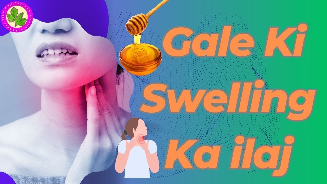 Gale Ki Sujan Ka Fori ilaj - Gale Ki Swelling Ka Ilaj - YouTube