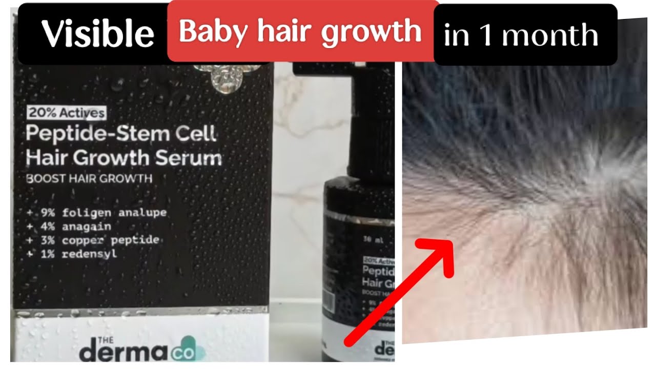 derma co peptide stem cell hair growth serum review #dermaco - YouTube