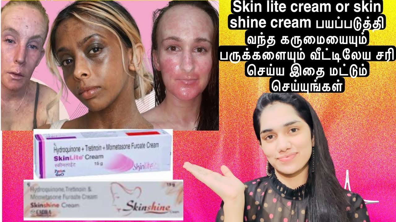 Cure skin shine or skin lite cream’s side effects easily at home 💯 ...