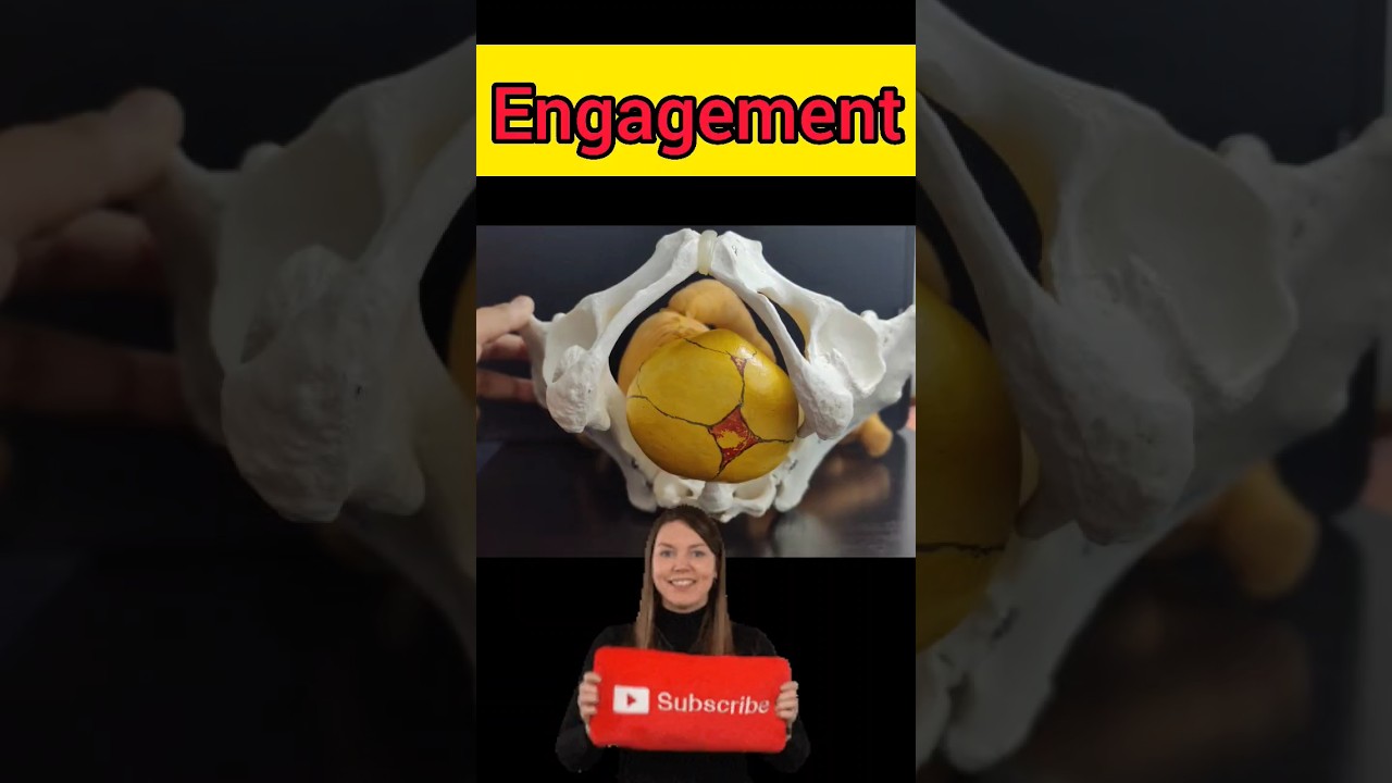 Engagement.Mechanism of labour.#normallabour#normaldelivery - YouTube