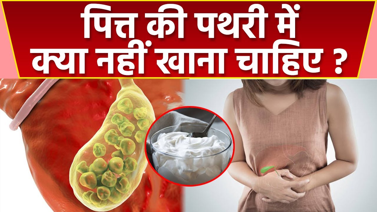पित्त की पथरी में क्या नहीं खाना चाहिए ? | gallbladder stones में क्या ...