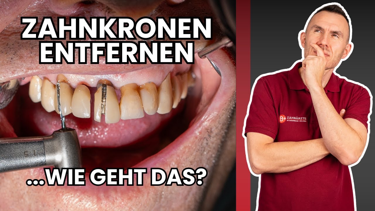 Zahnkronen & Zahnbrücken entfernen (und wieder verwenden)? Kompletter ...