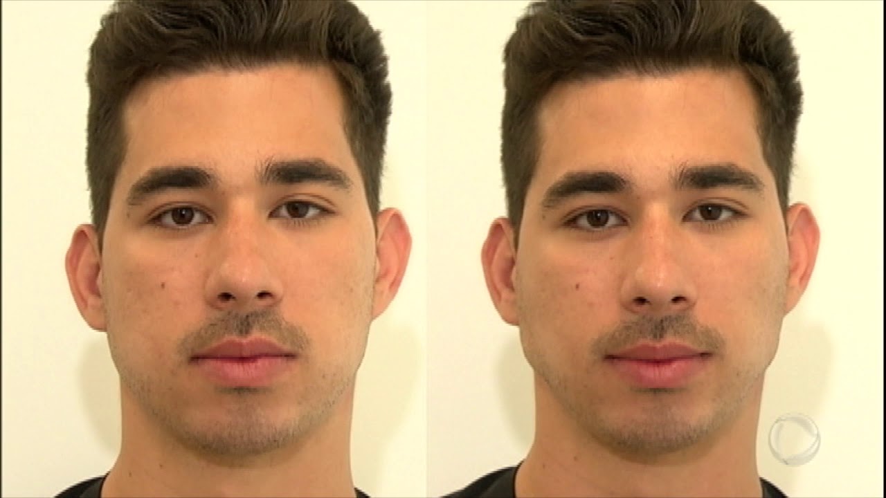 Homens fazem procedimento estético para ter queixo do Brad Pitt - YouTube