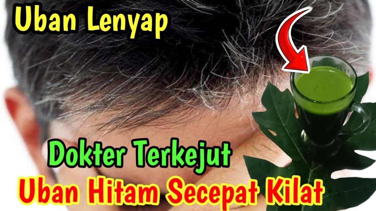 UBAN HILANG SELAMANYA TANPA SEMIR RAMBUT !! CARA MENGHITAMKAN UBAN ...
