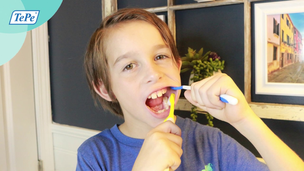How to manage children’s teeth - Part 2 - YouTube