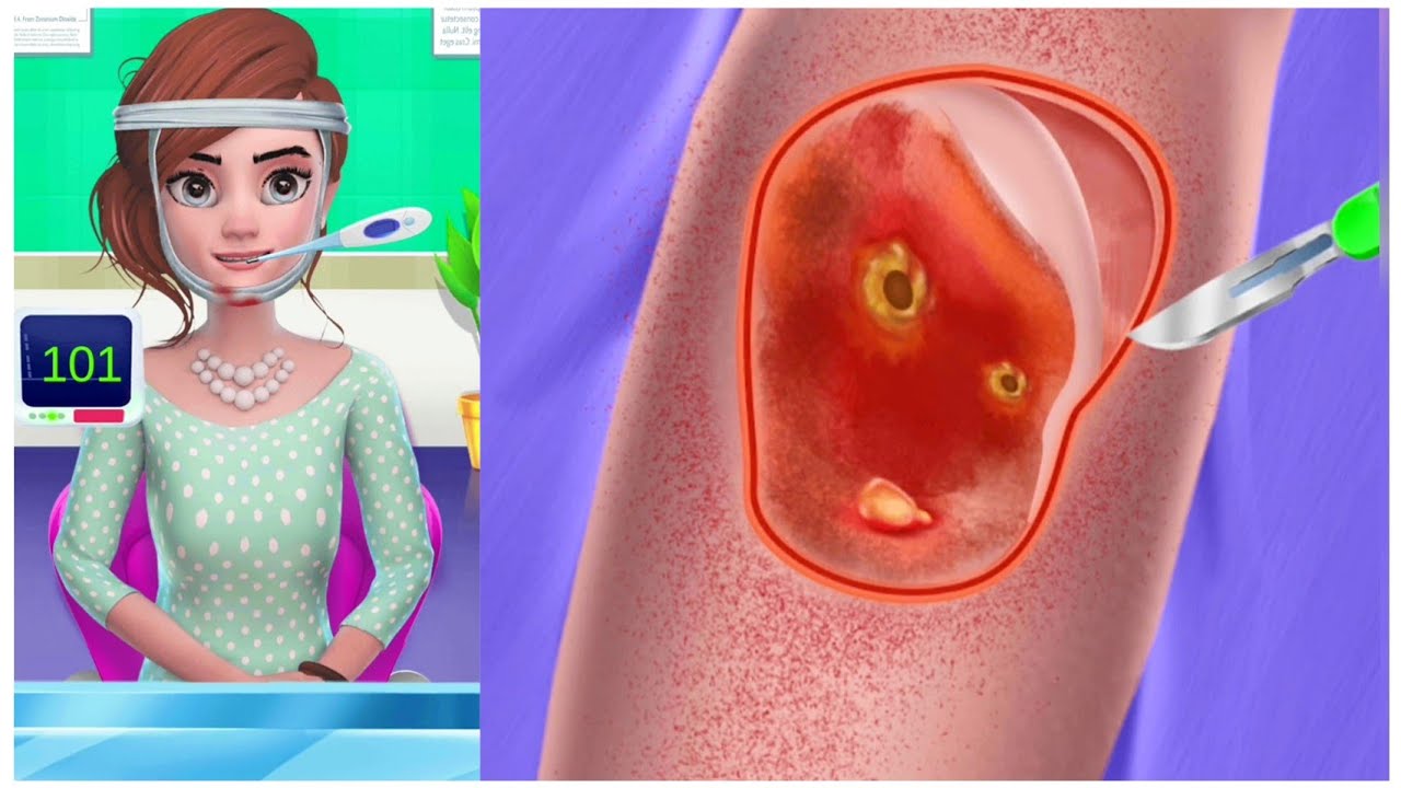 ASMR animation doctor surgery - YouTube