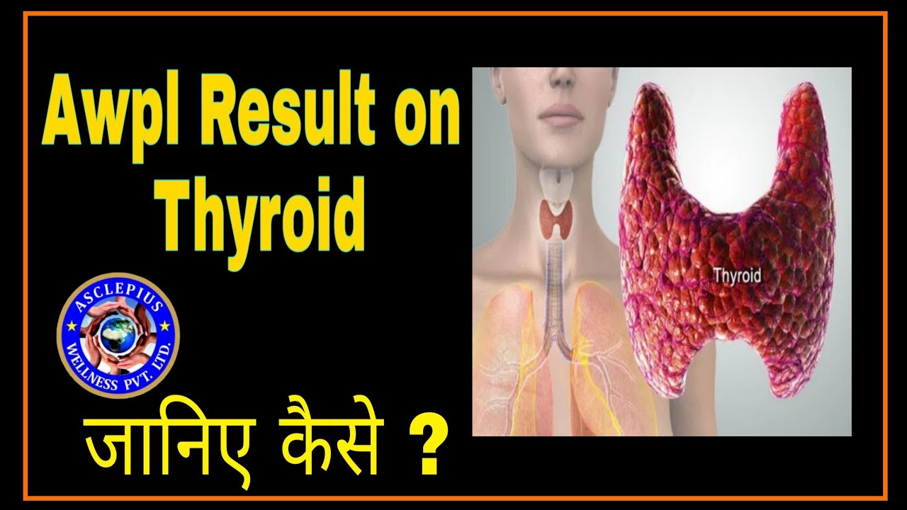 AWPL result Thyroid // Best result in one Month || contact for more ...