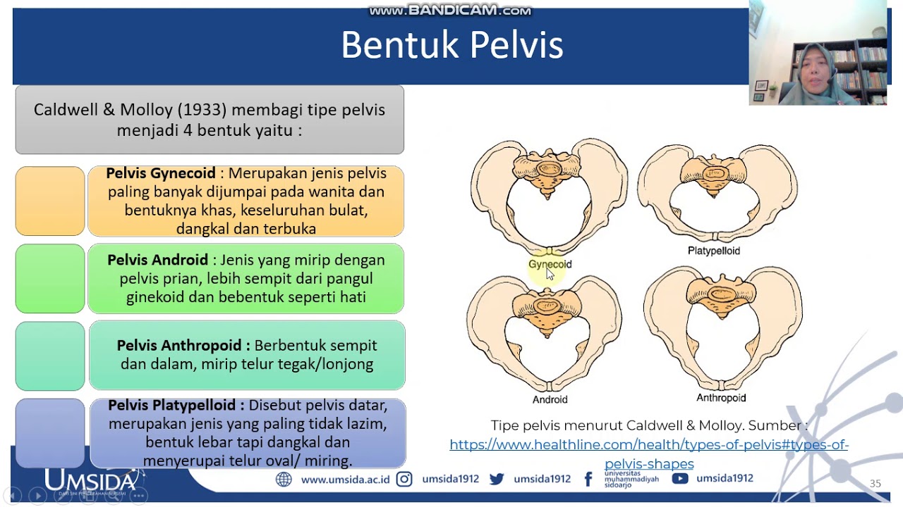 VIDEO SERI # 4 BIDANG HODGE, LIGAMENT PELVIS - YouTube